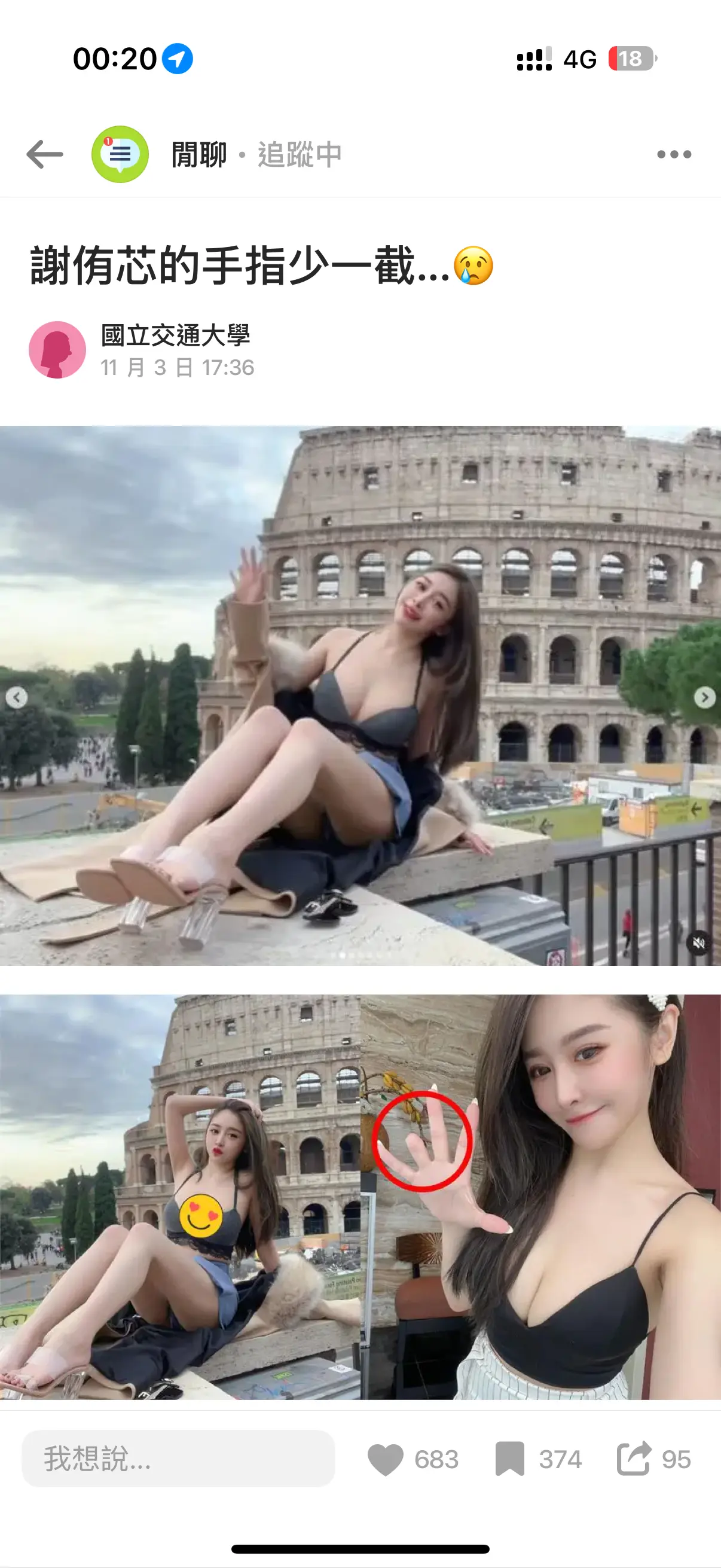 慎入，謝侑芯隻手指原來少咗一隻 | LIHKG 討論區