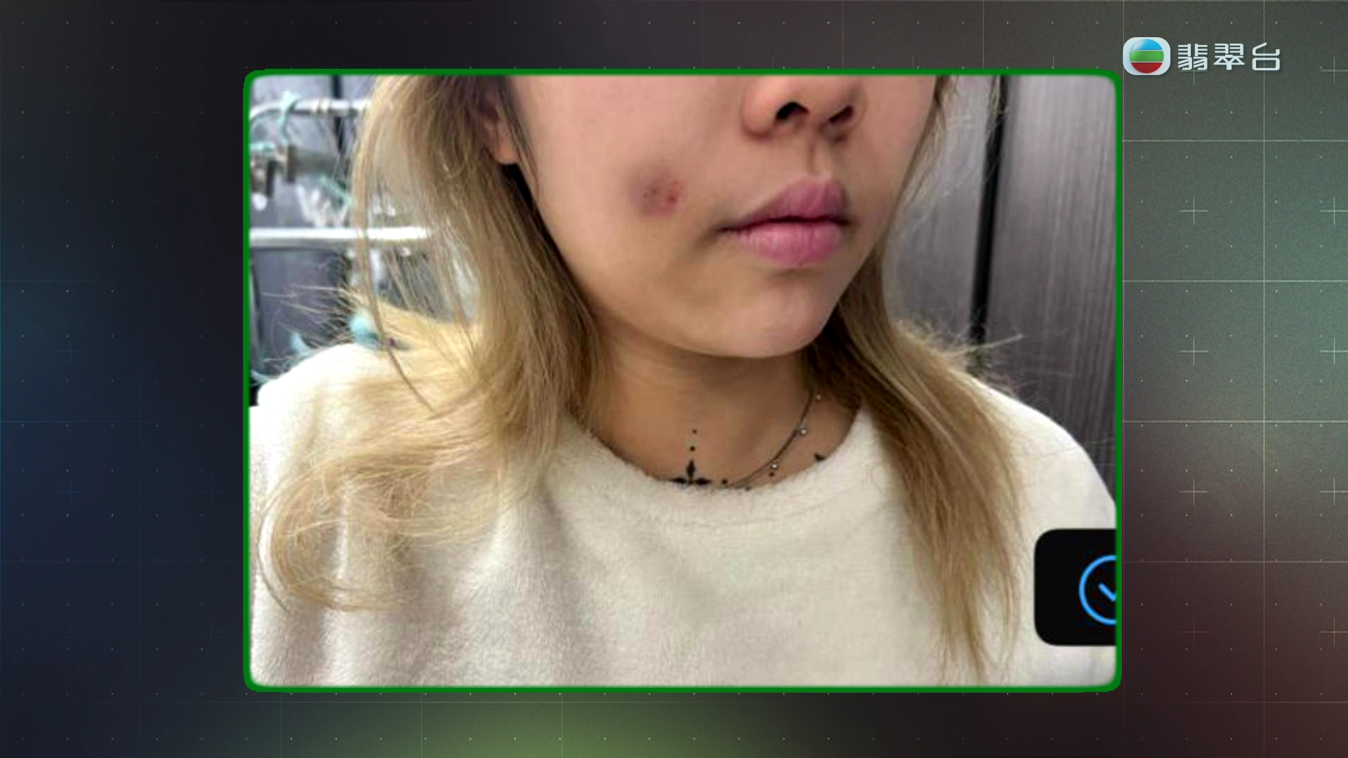 [TVB] 東張西望討論區 (118) | LIHKG 討論區