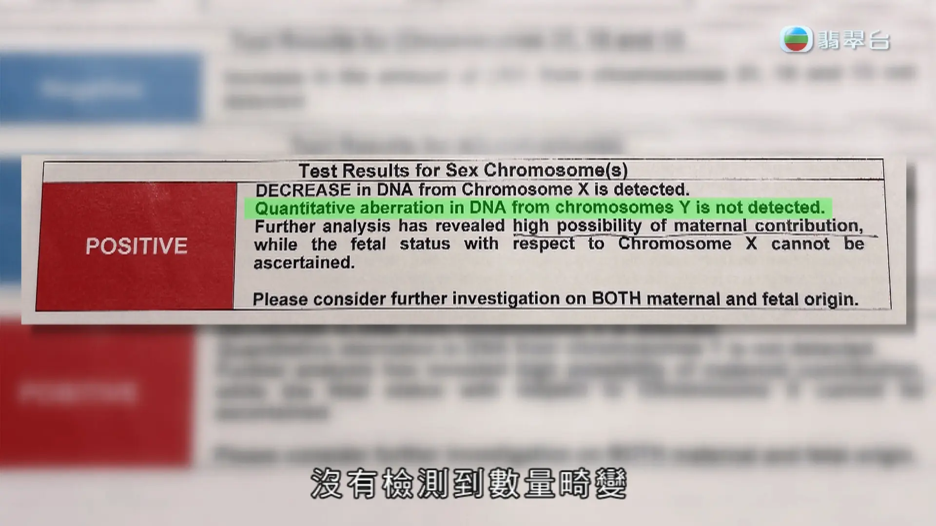 [TVB] 東張西望討論區 (225) | LIHKG 討論區