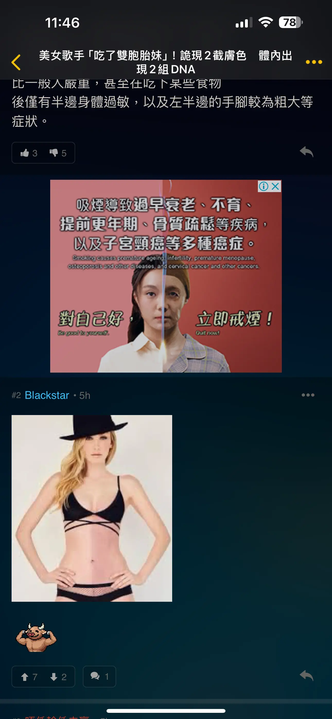 美女歌手「吃了雙胞胎妹」！詭現2截膚色 體內出現2組DNA | LIHKG 討論區