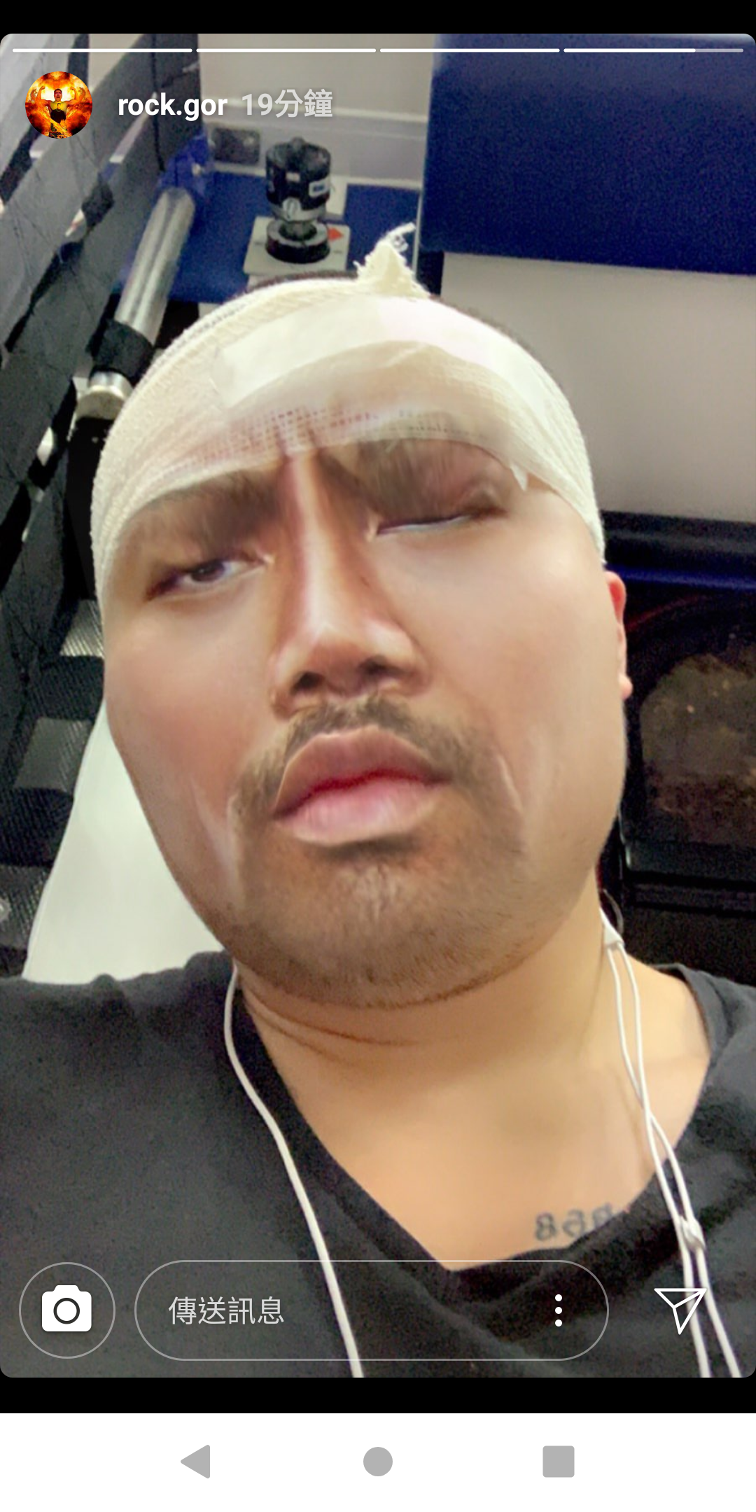 [突發]ROCK哥元朗俾人打！！ | LIHKG 討論區