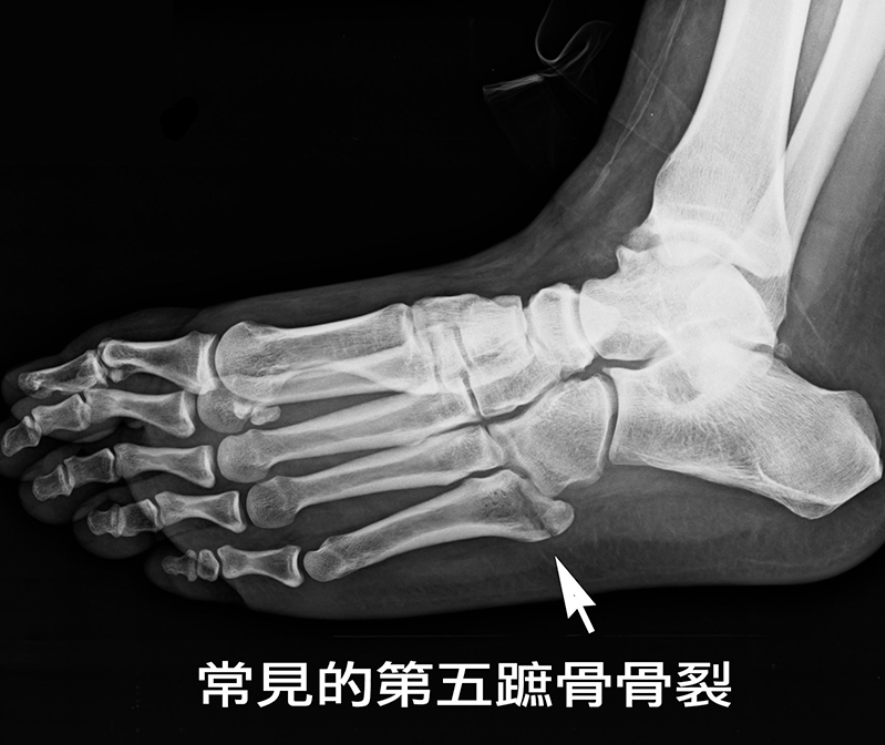 乃木坂46討論區#533：賀喜遥香お誕生日おめでとう！ | LIHKG 討論區