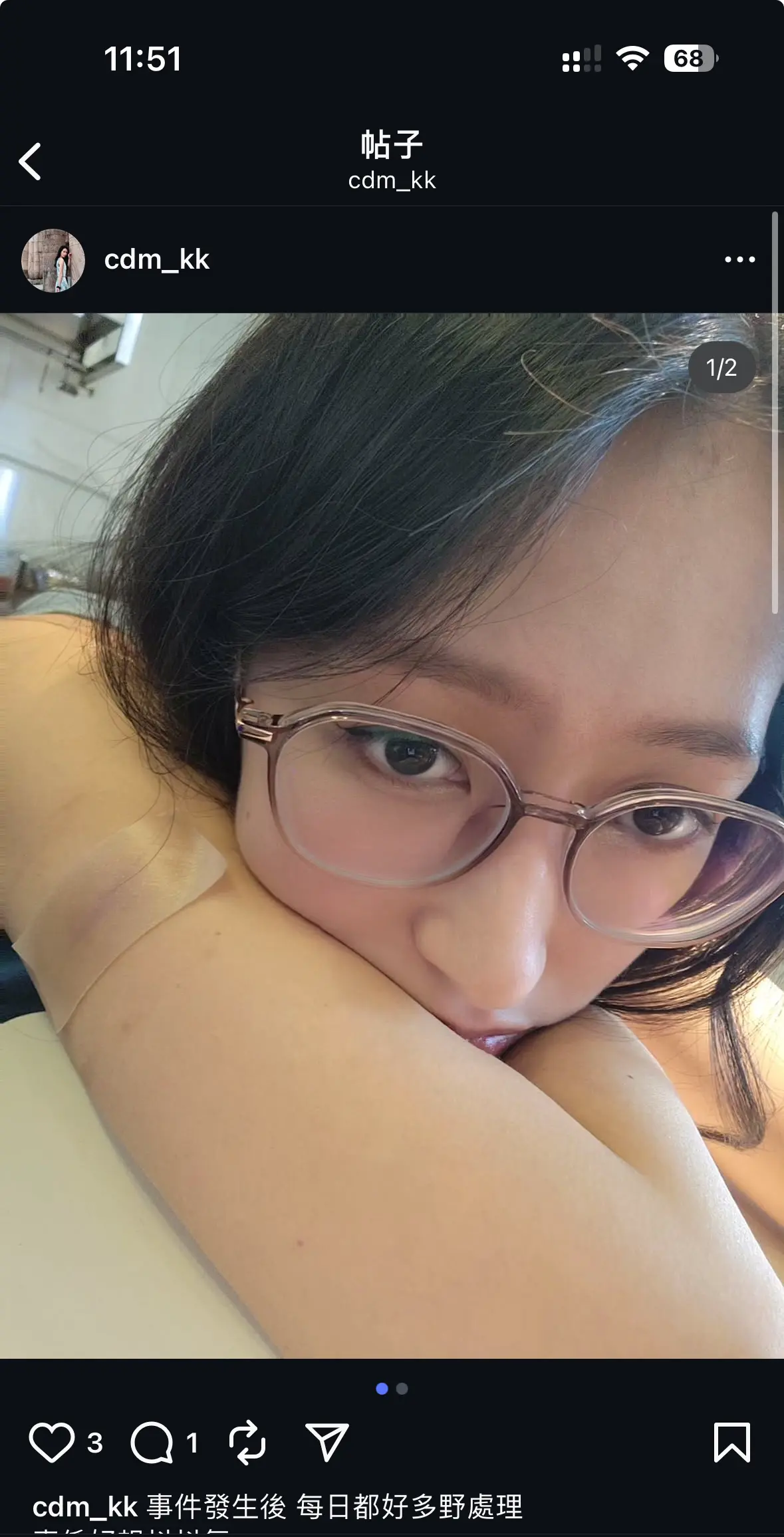 劏房觸電妹開左 Patreon | LIHKG 討論區
