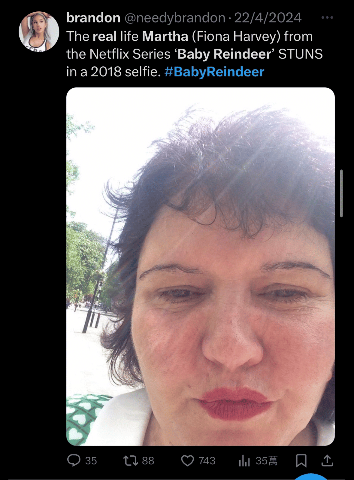 Baby Reindeer netflix | LIHKG 討論區