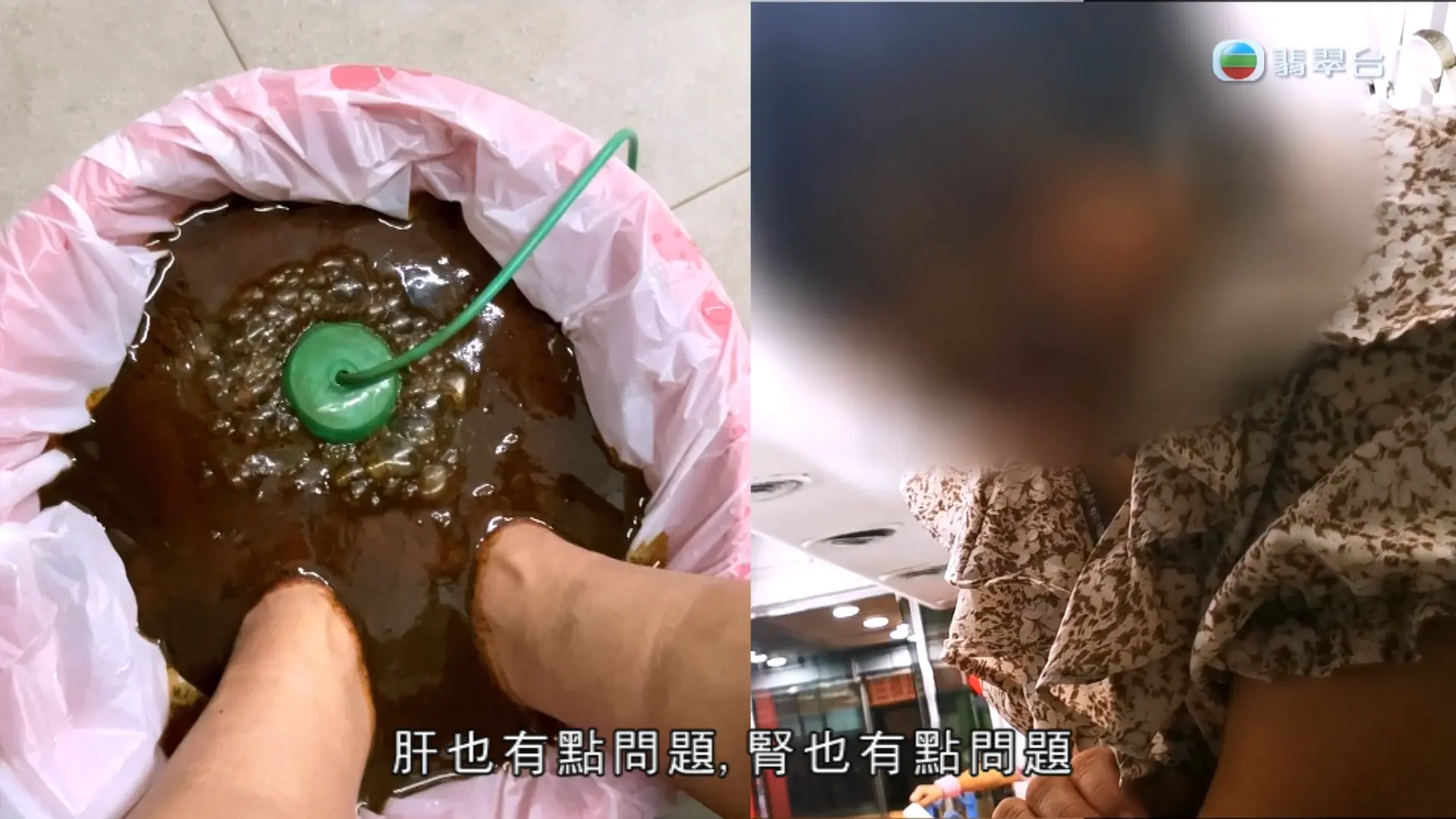 [TVB] 東張西望討論區 (193) | LIHKG 討論區