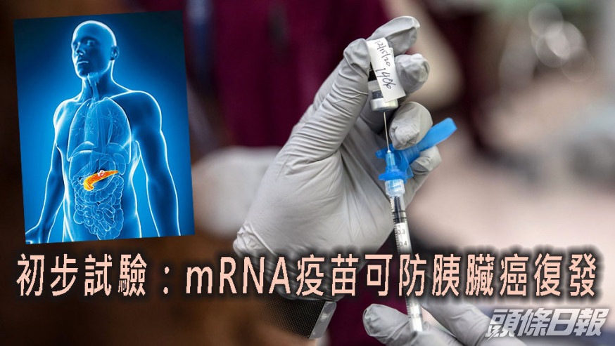美國科學家與BioNTech初步研究指mRNA疫苗可防胰臟癌復發 | LIHKG 討論區